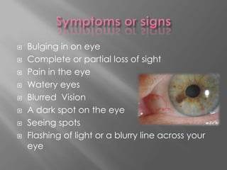 Eye Cancer | PPT