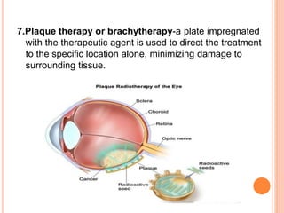 EYE CANCER.pptx prepared by Neha kewat digital learning | PPTX