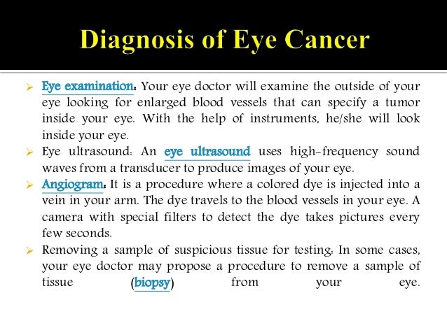 Eye Cancer (Eye Melanoma): Symptoms, Causes, Diagnosis and Treatment.