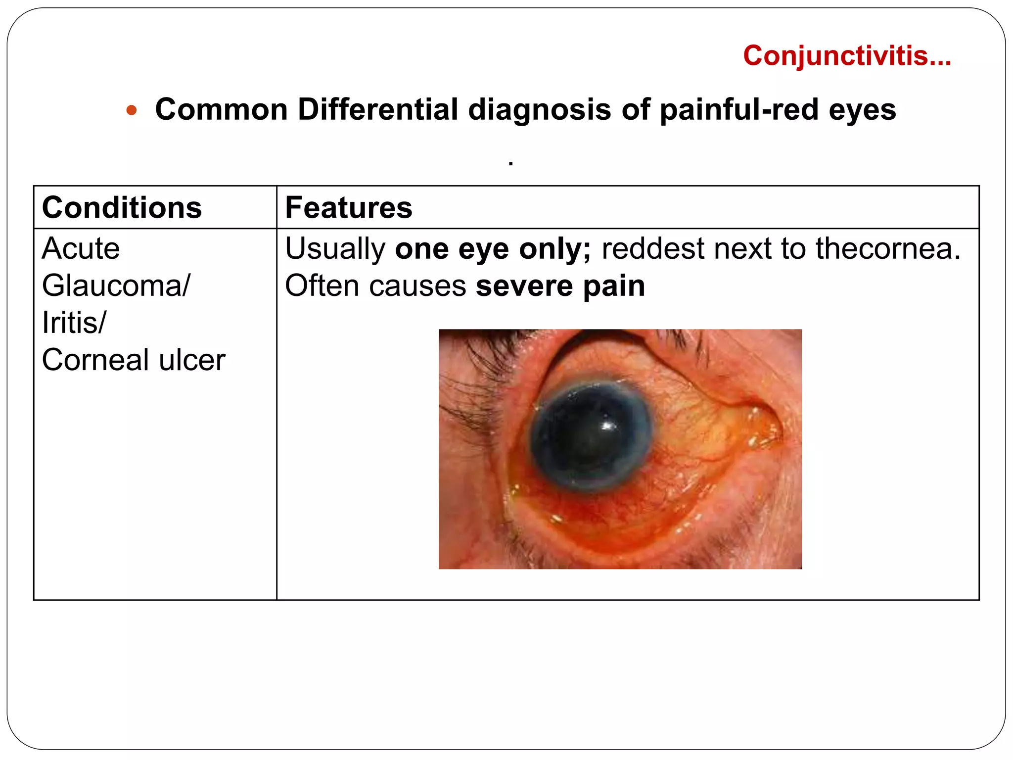 Eye care - Common Eye related Conditions.pptx