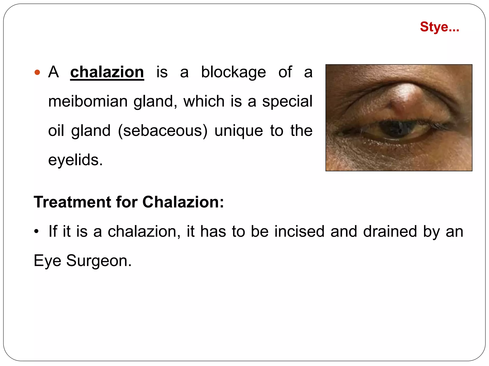 Eye care - Common Eye related Conditions.pptx