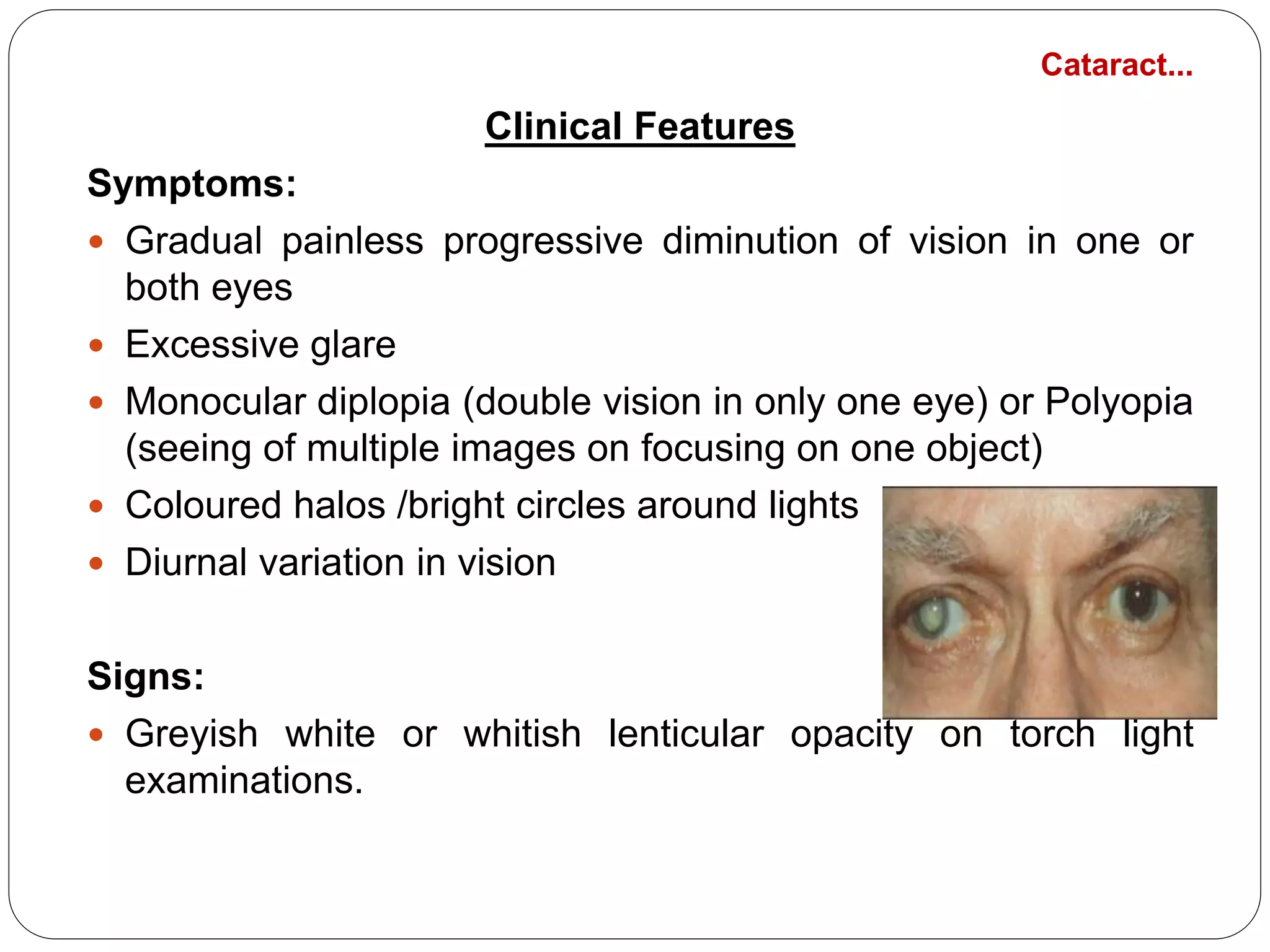 Eye care - Common Eye related Conditions.pptx