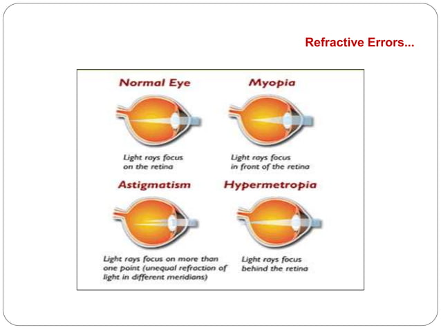 Eye care - Common Eye related Conditions.pptx | Eye and Vision ...