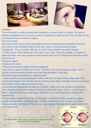 Eye care | PDF