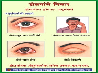 EYE CARE | PPT