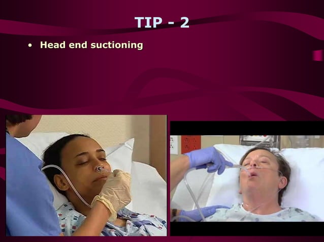 Eye care tips in ICU | PPT