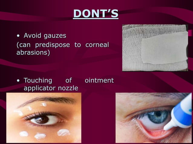 Eye care tips in ICU | PPT