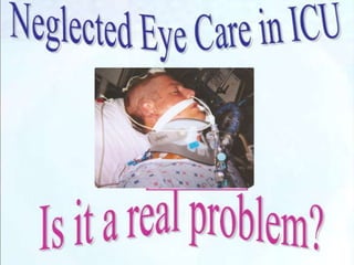 Eye care tips in ICU | PPT
