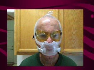 Eye care tips in ICU | PPT