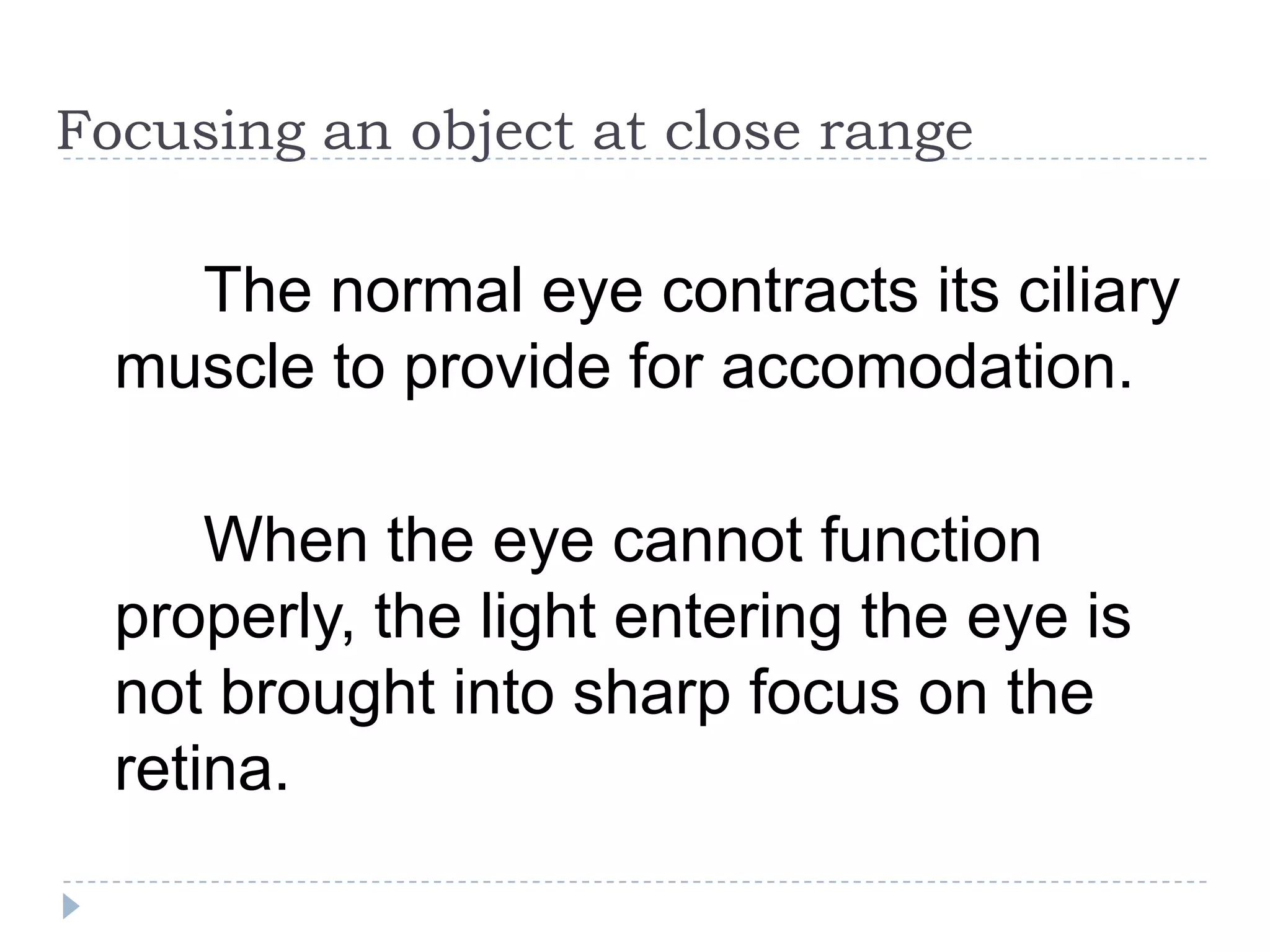 Eye defects and lenses | PPTX
