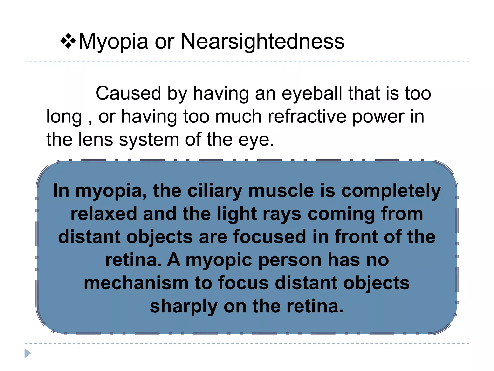 Eye defects and lenses | PPTX