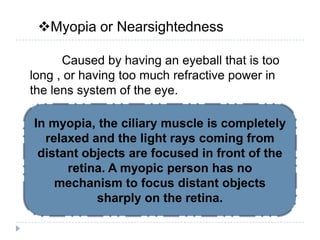 Eye defects and lenses | PPTX