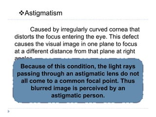 Eye defects and lenses | PPTX