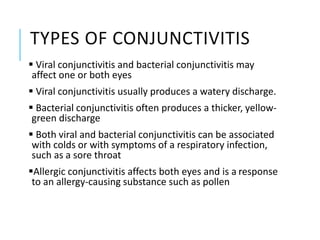 common eye diseases powerpoint presentation | PPTX