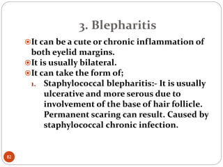 Eye disorder medical surgical nursing.ppt