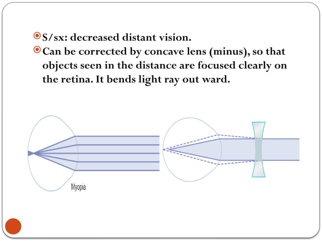 Eye disorder- Medical surgical Nursing.pptx