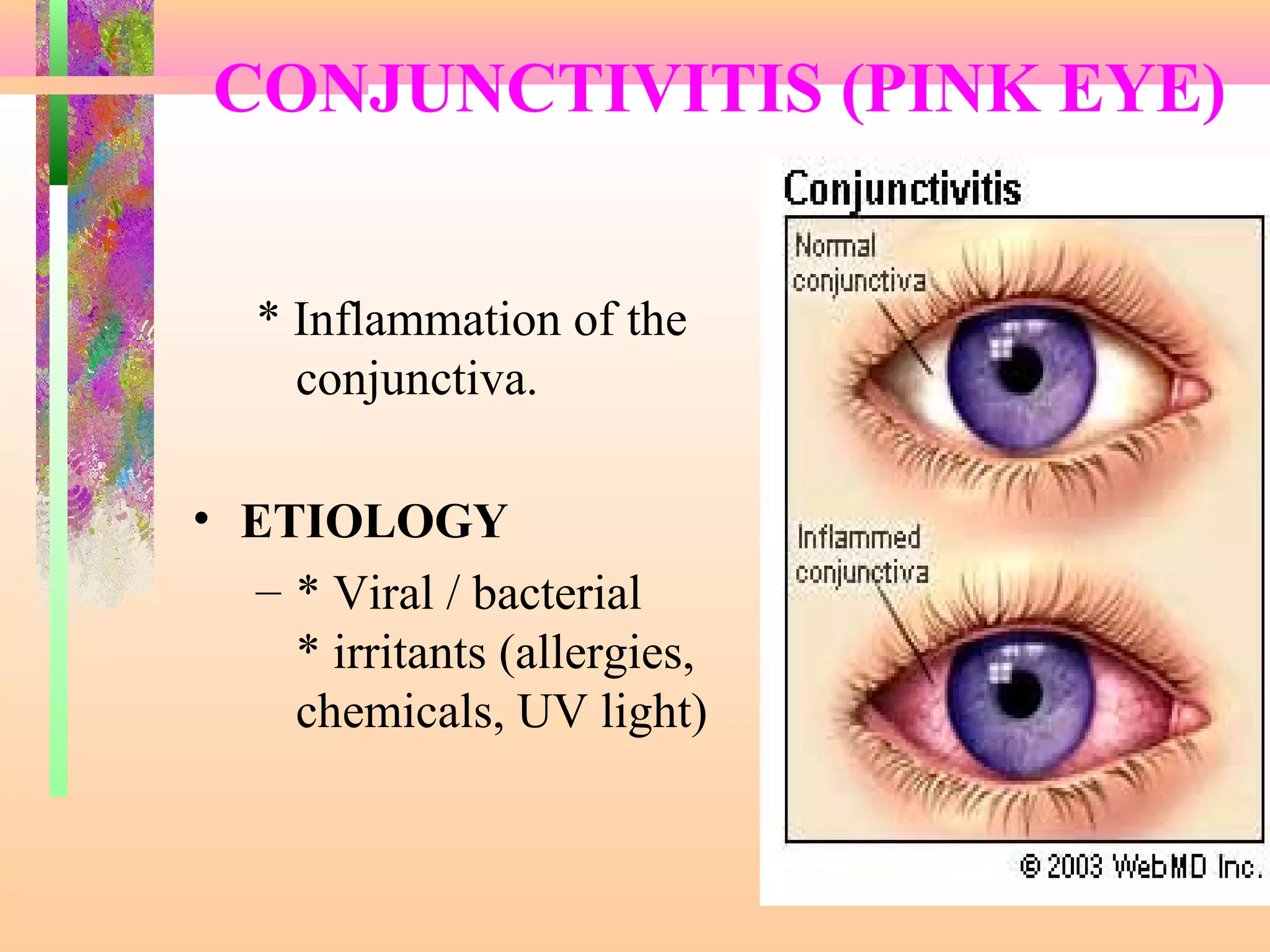 Eye diseases & disorders | PPT | Eye and Vision Conditions | Diseases ...