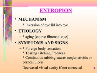 Eye diseases & disorders | PPT