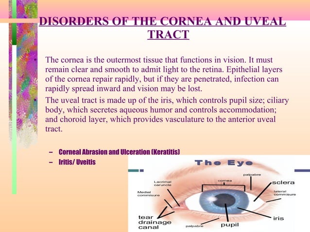 Eye diseases & disorders | PPT | Eye and Vision Conditions | Diseases ...