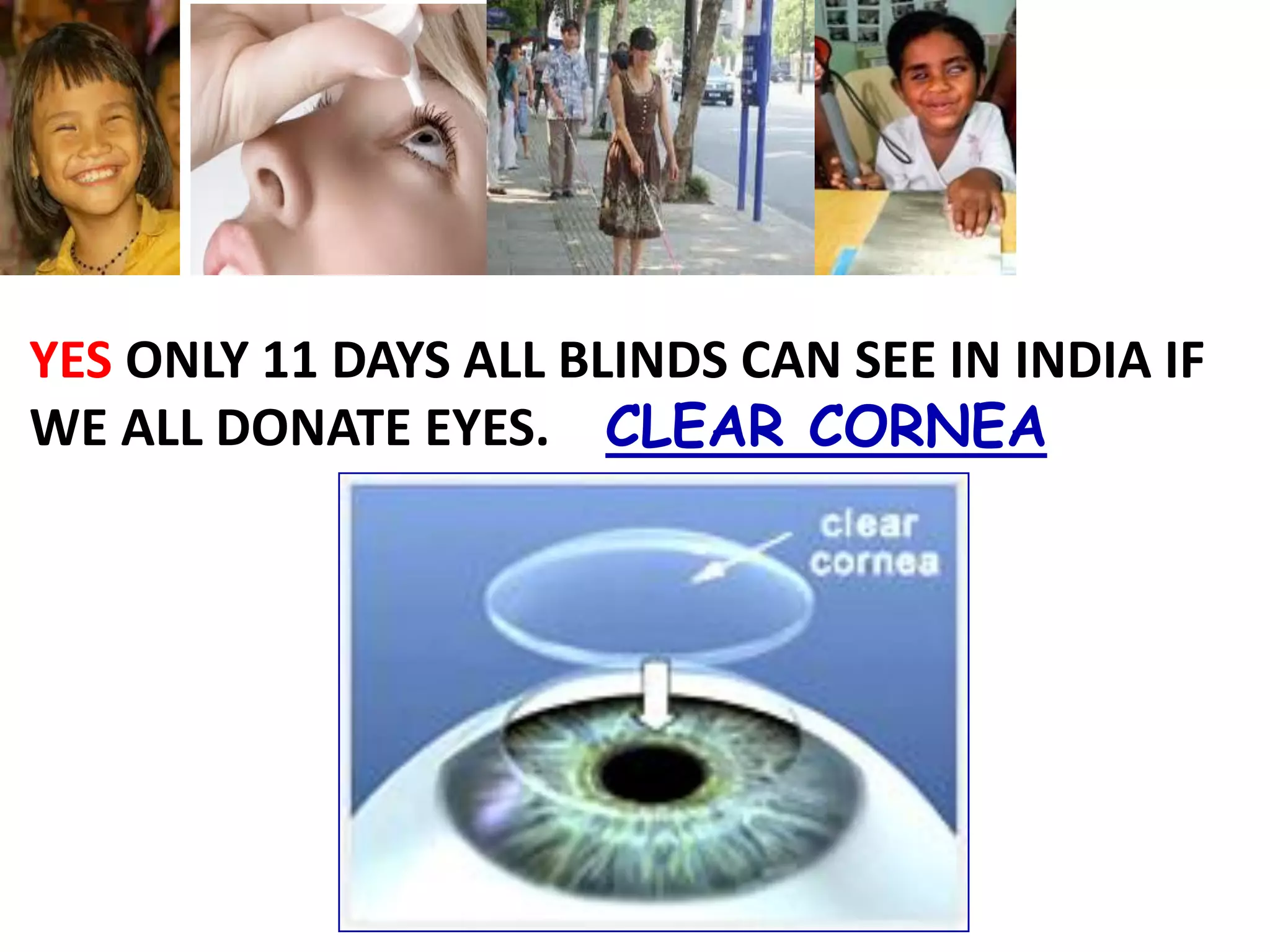 Eye donation | PDF | Eye and Vision Conditions | Diseases and Conditions