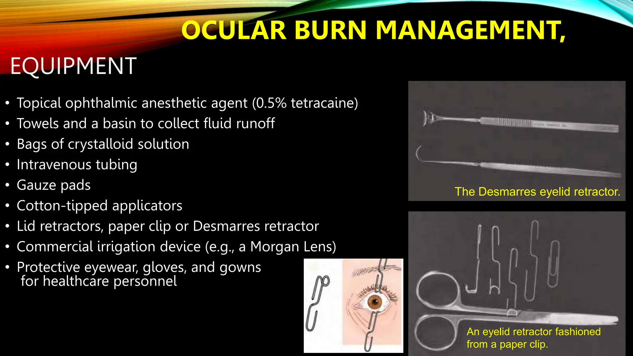 Eye drop or ointment placement. Ocular burn.contact lens.pptx
