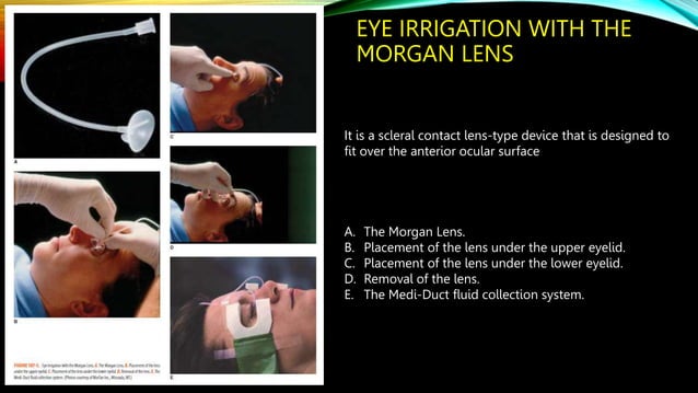 Eye drop or ointment placement. Ocular burn.contact lens.pptx
