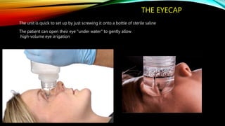 Eye drop or ointment placement. Ocular burn.contact lens.pptx