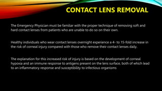 Eye drop or ointment placement. Ocular burn.contact lens.pptx