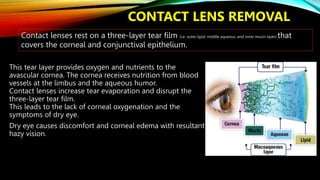 Eye drop or ointment placement. Ocular burn.contact lens.pptx