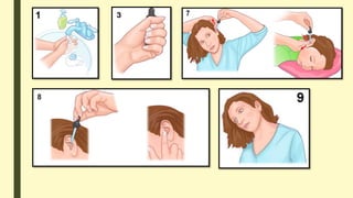 Eye, ear & nasal instillation nursing foundations.pptx