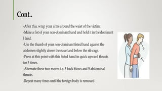 eye ear nose throat foreign body first aid.pptx