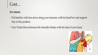 eye ear nose throat foreign body first aid.pptx