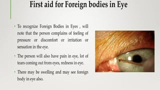 eye ear nose throat foreign body first aid.pptx