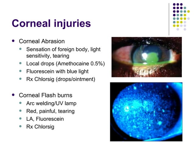 Eye emergencies | PPT
