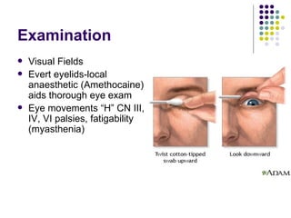Eye emergencies | PPT