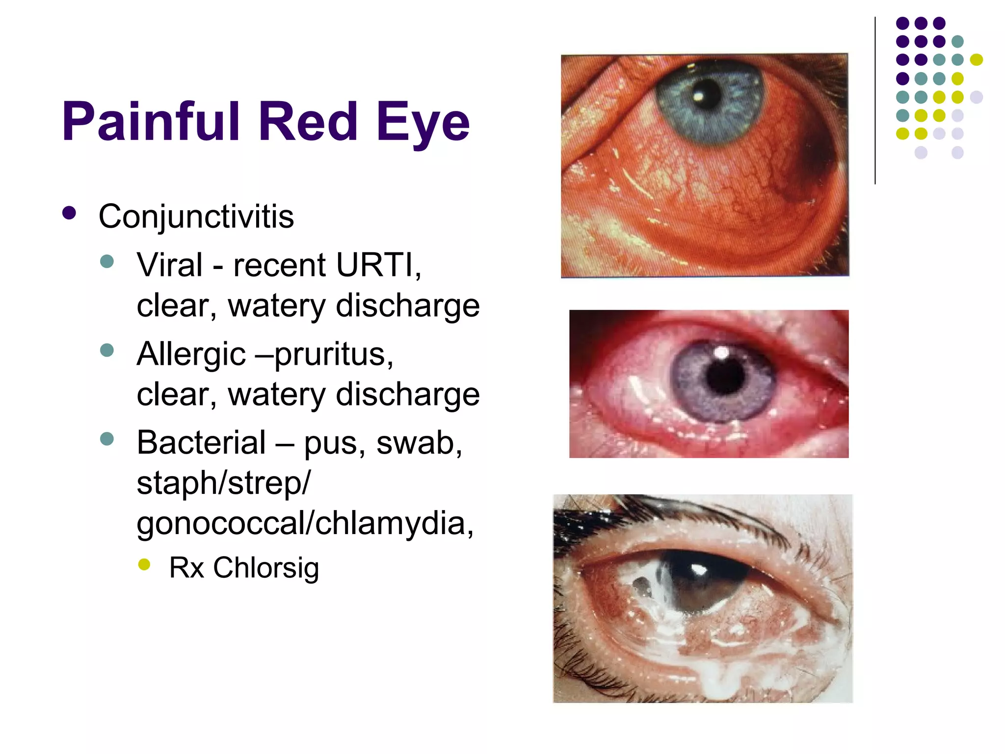 Eye emergencies emc | PPT