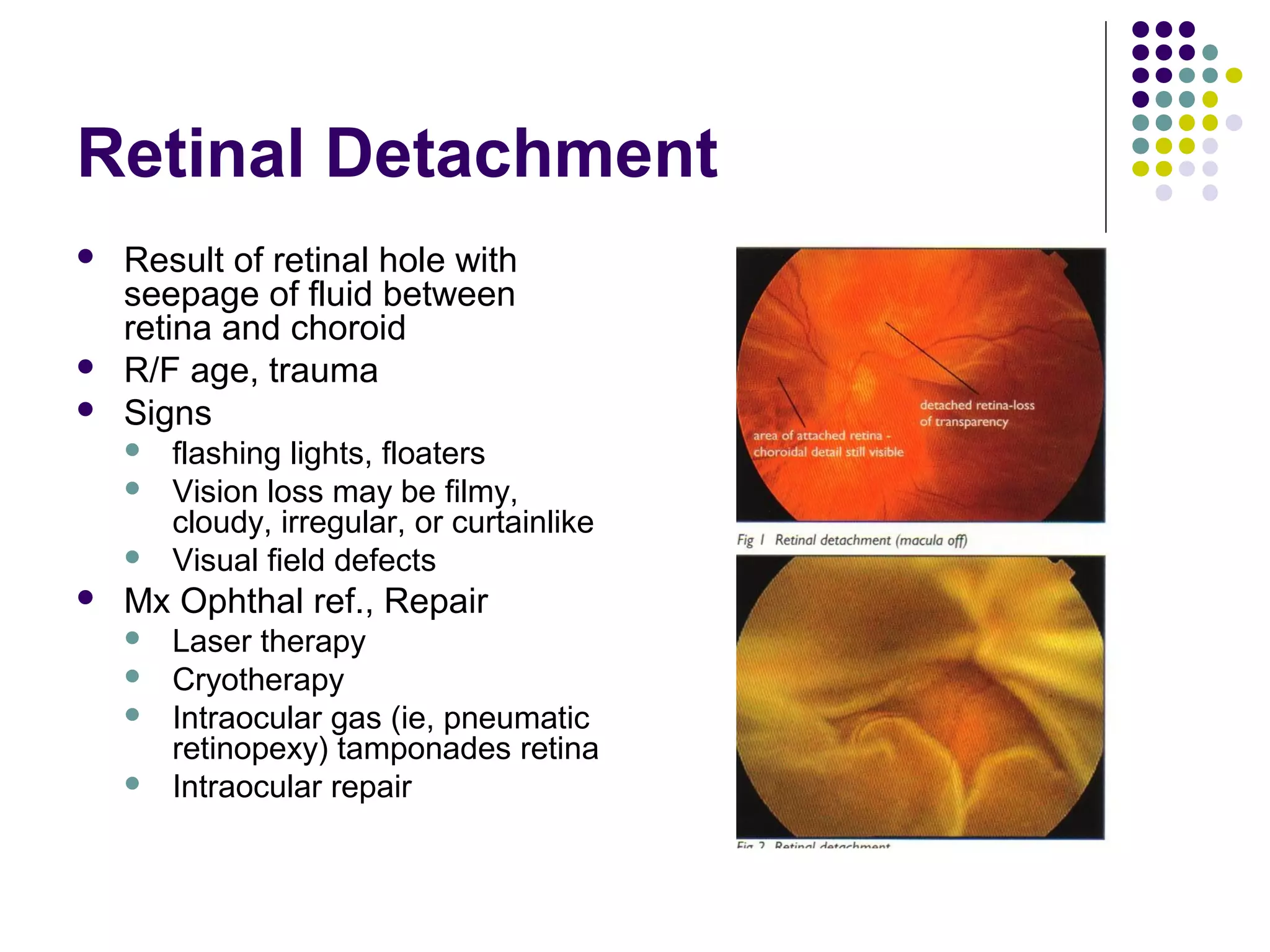 Eye emergencies emc | PPT