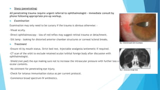 Eye & ent emergencies | PPTX