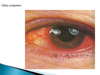 Eye Examination | PPTX