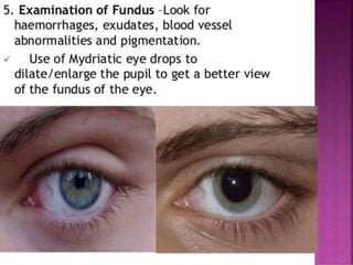 Eye examination presentation | PPT