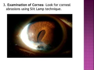 Eye examination presentation | PPT