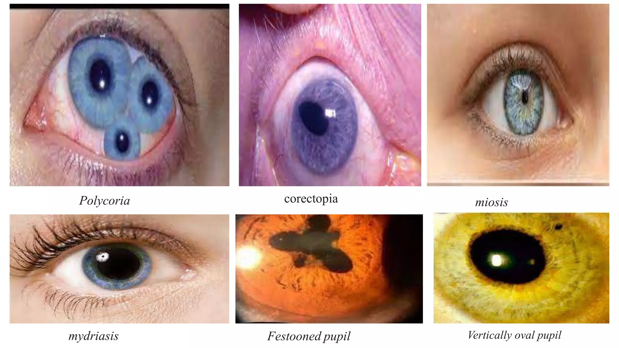 eye examination.pptx