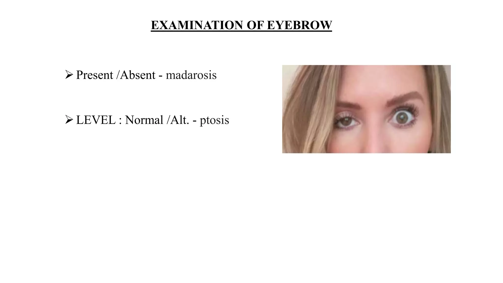 eye examination.pptx