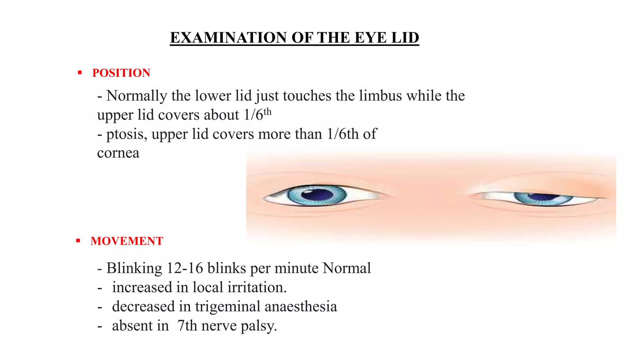 eye examination.pptx