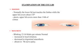 eye examination.pptx