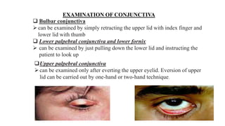 Conjunctiva Inspection