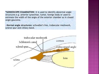 EYE EXAMINATION.pptx