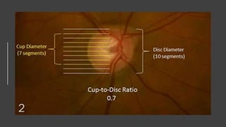 Eye Examination - Trauma Emergency | PPTX | First Aid | Injuries