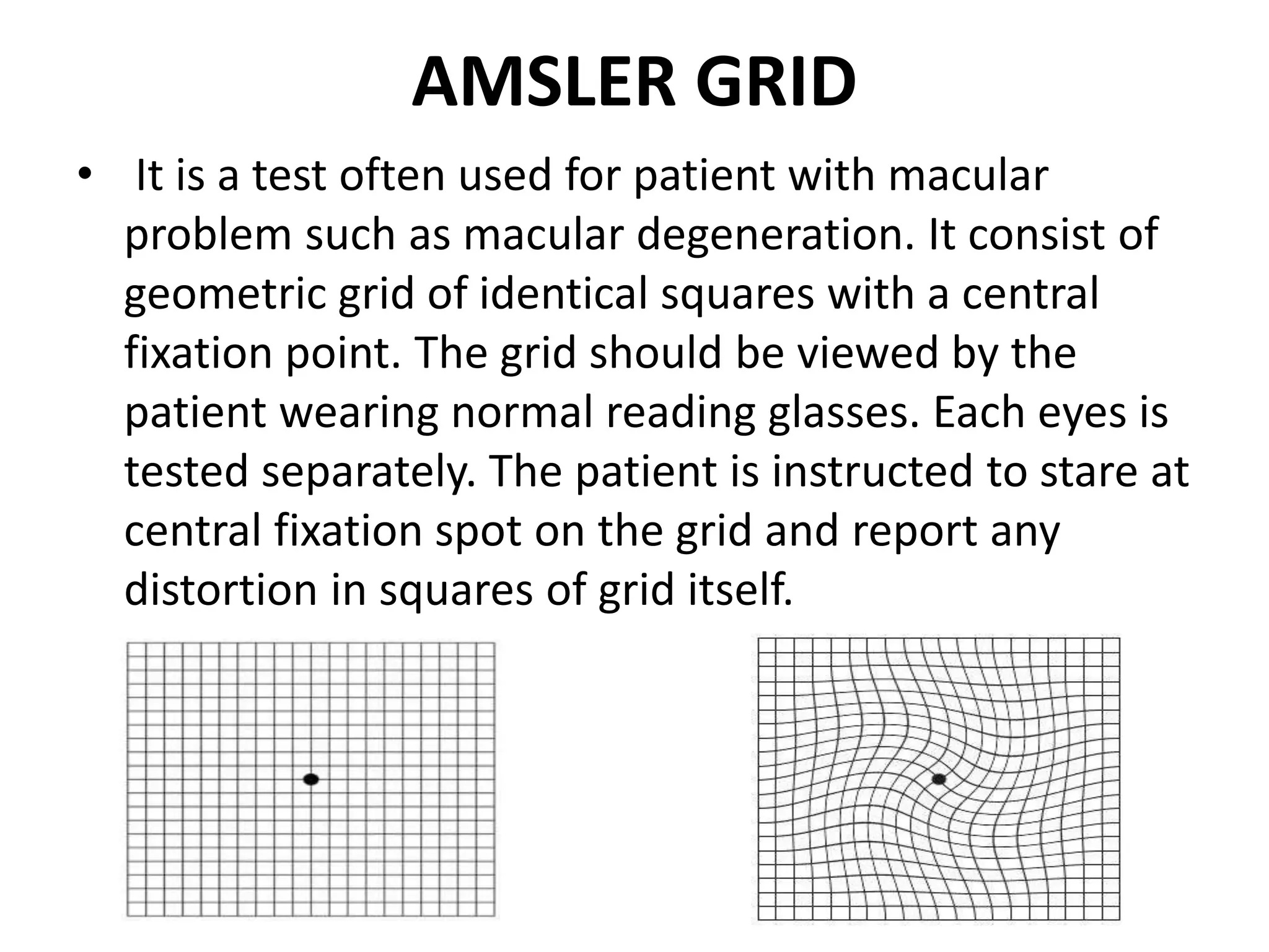 EYE EXAMINATION(Linda).pptx