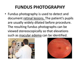 EYE EXAMINATION(Linda).pptx